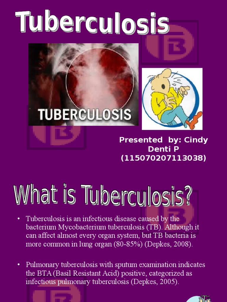 TBC Presentation by Cindy | PDF | Tuberculosis | Immunology