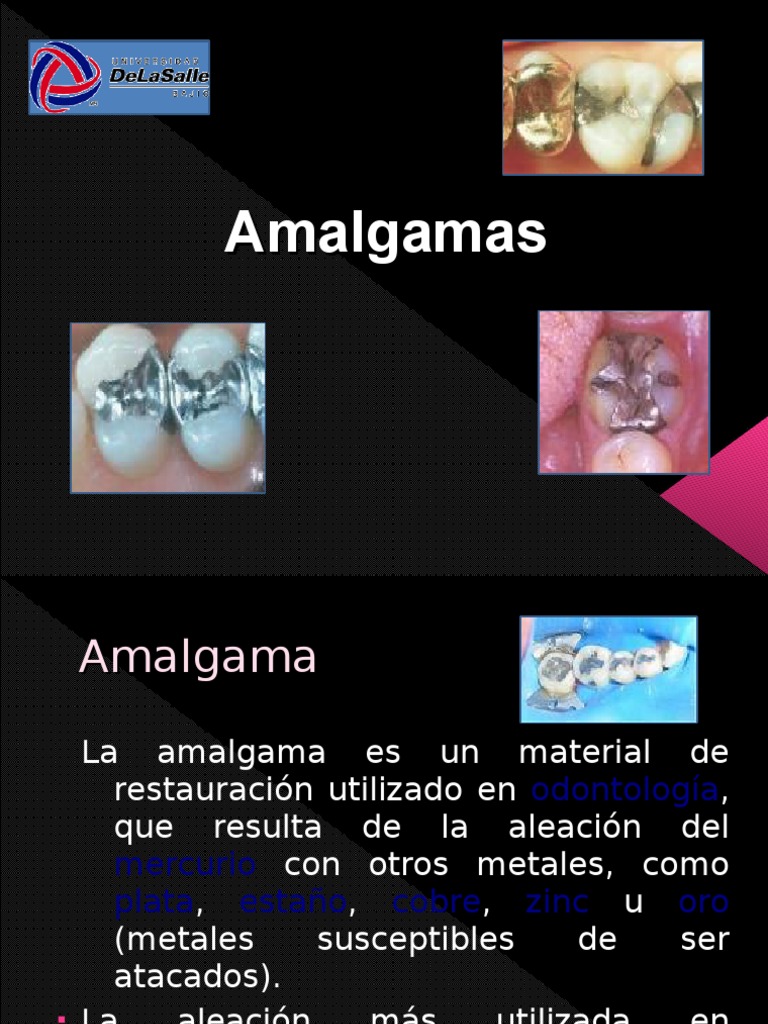 La Amalgama Es Un Material de Restauración | Cobre | Mercurio (Elemento)