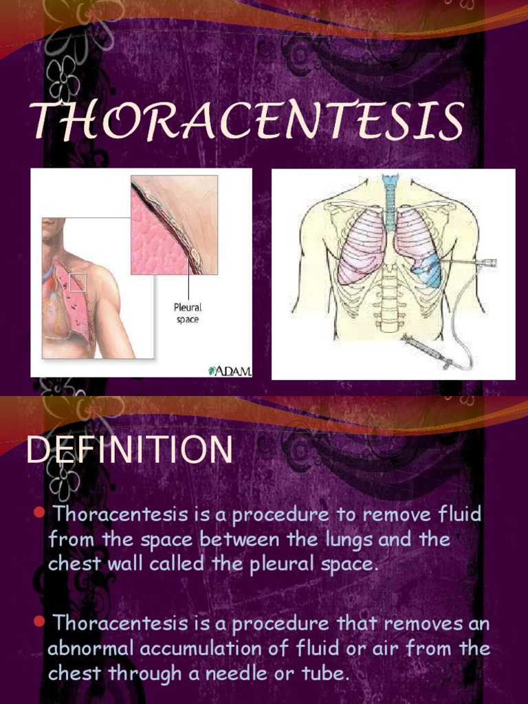 Thoracentesis | Respiratory System | Clinical Medicine
