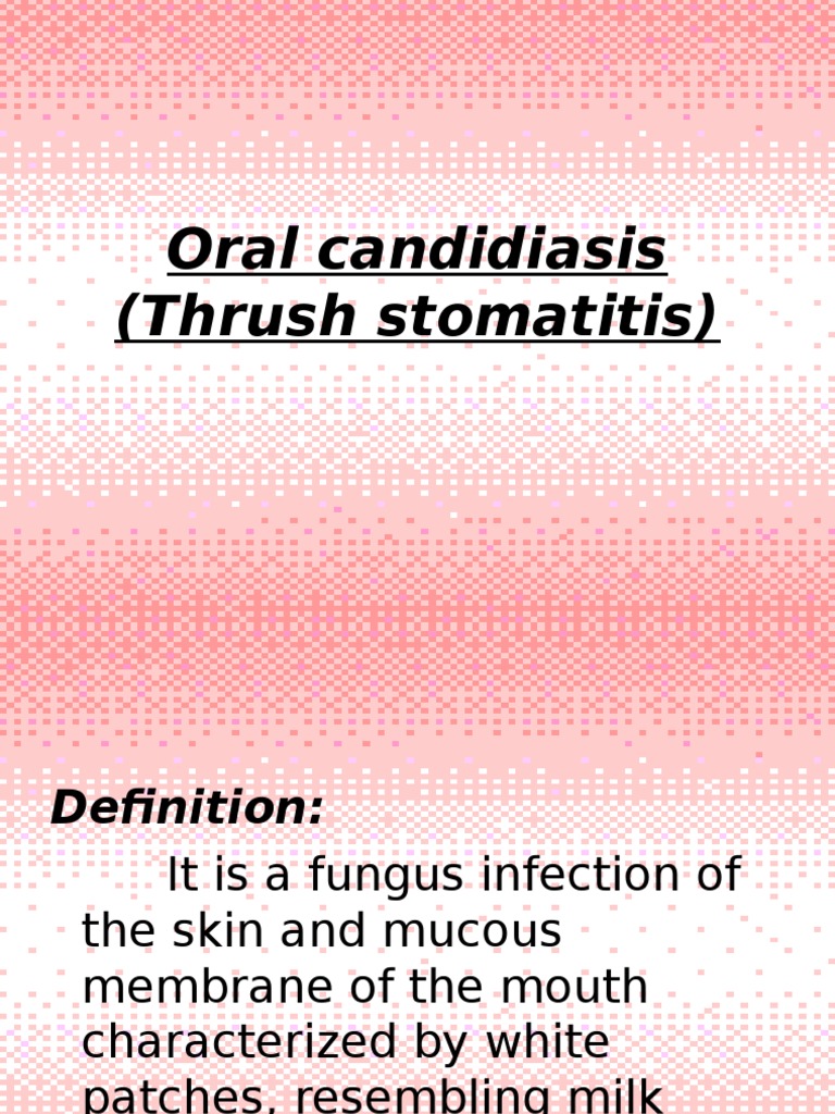 2. Oral Candidiasis Thrush Stomatitis | Candidiasis | Medical Specialties