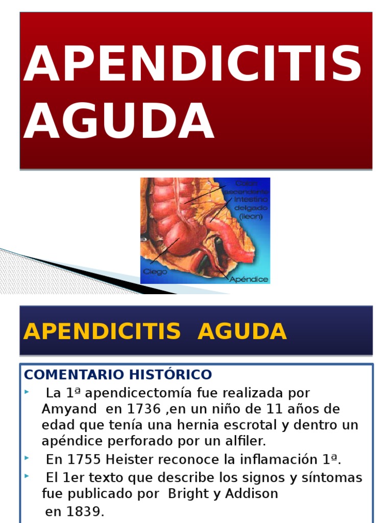 Apendicitis Aguda | PDF | Inmunología | Enfermedades y trastornos
