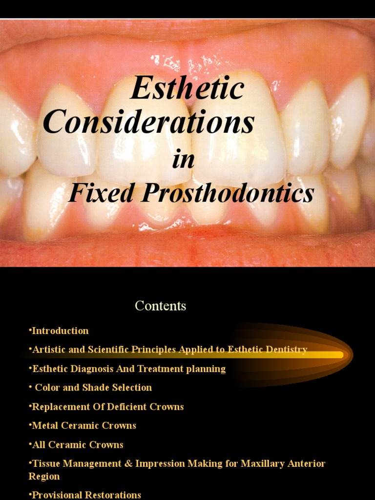 Esthetics in FPD | PDF | Mouth | Dentistry