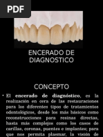 Materiales y Tecnicas de Encerado | PDF | Ramas de Odontología