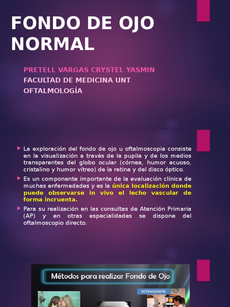Fondo de Ojo Normal | PDF | Ojo humano | Percepción visual