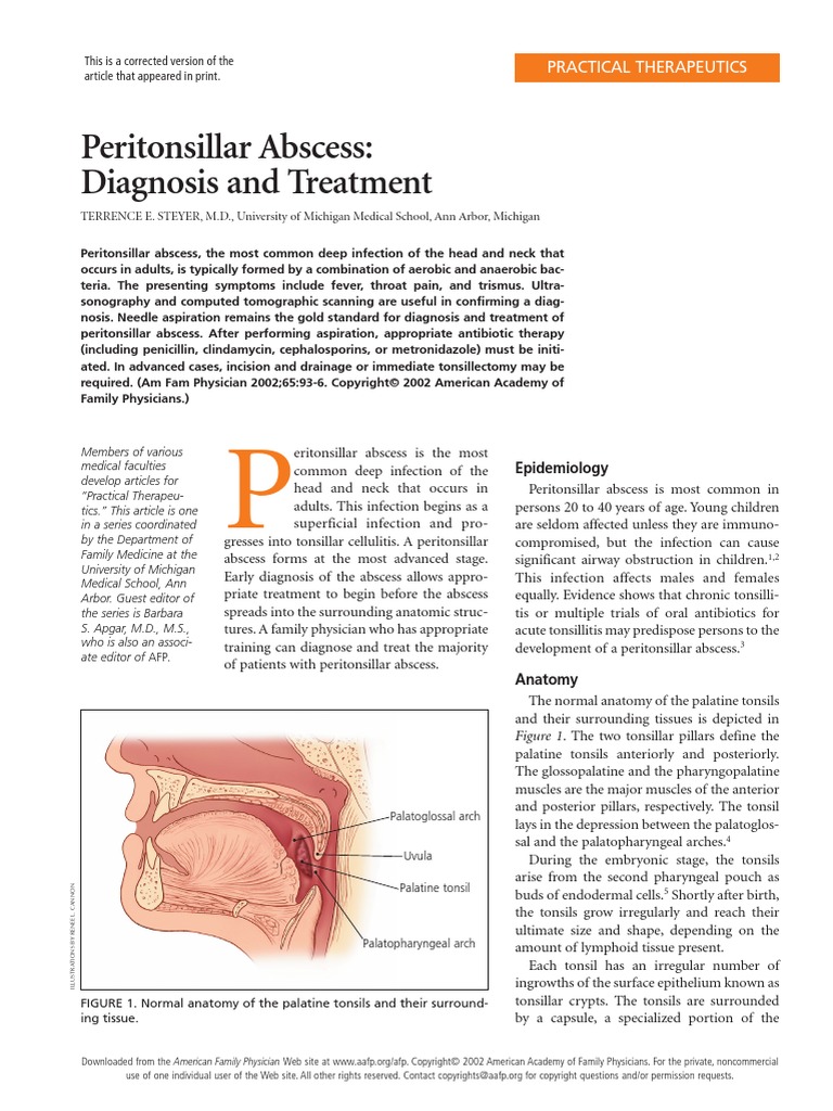 Peritonsillar Abscess Drainage | PDF | Medical Ultrasound | Streptococcus