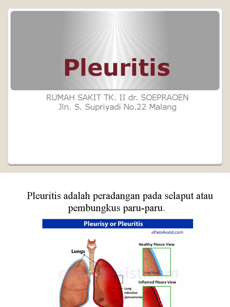 PLEURITIS | PDF