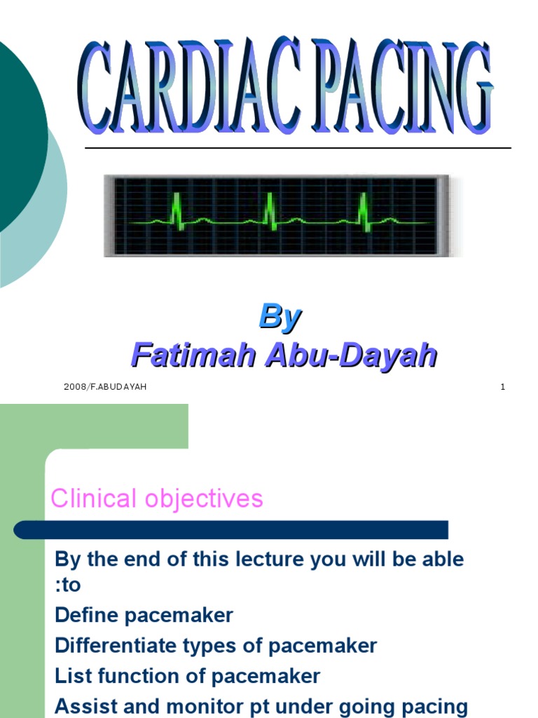 Pacemaker Pdf