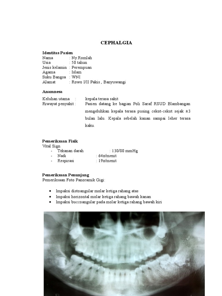 Cephalgia | PDF