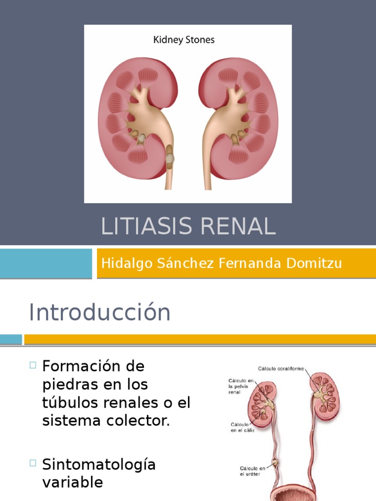 Litiasis Renal: Formación y Tratamiento | PDF | Calcio | Orina