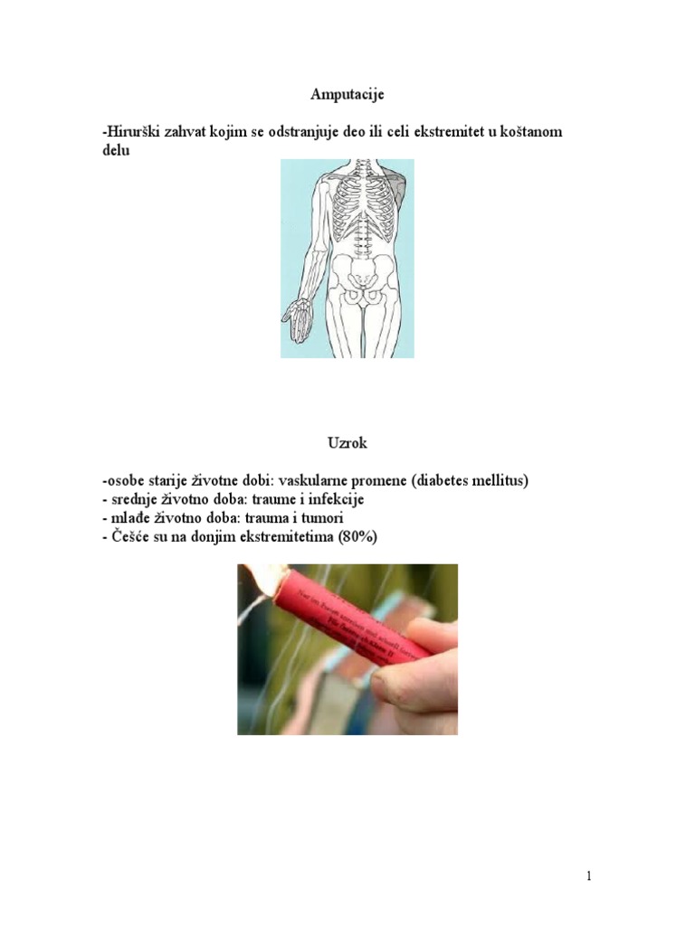 Amputacija Seminarski Rad | PDF
