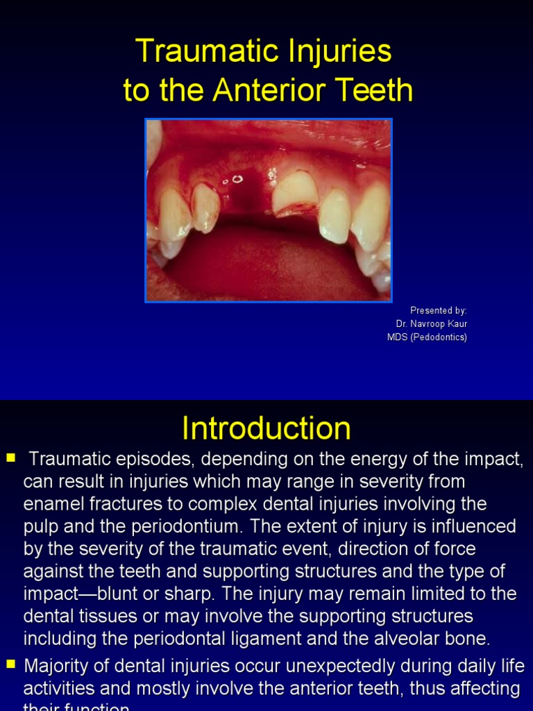 Tooth Trauma | PDF | Human Tooth | Dentistry