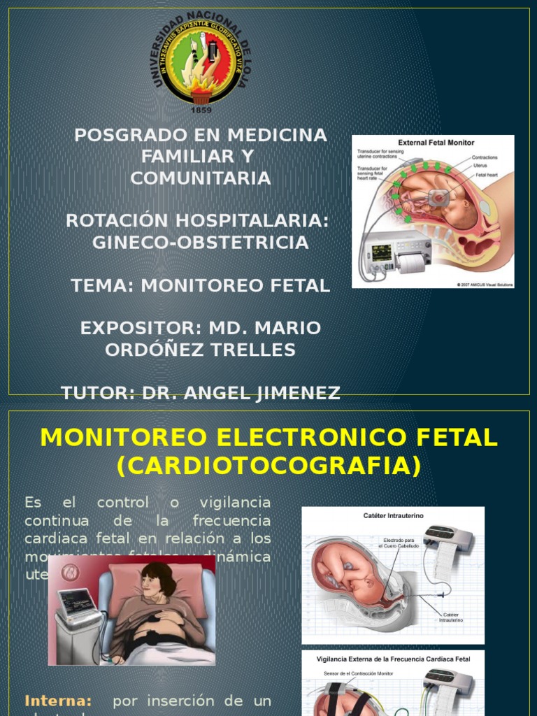 Monitoreo Fetal | Parto | El embarazo