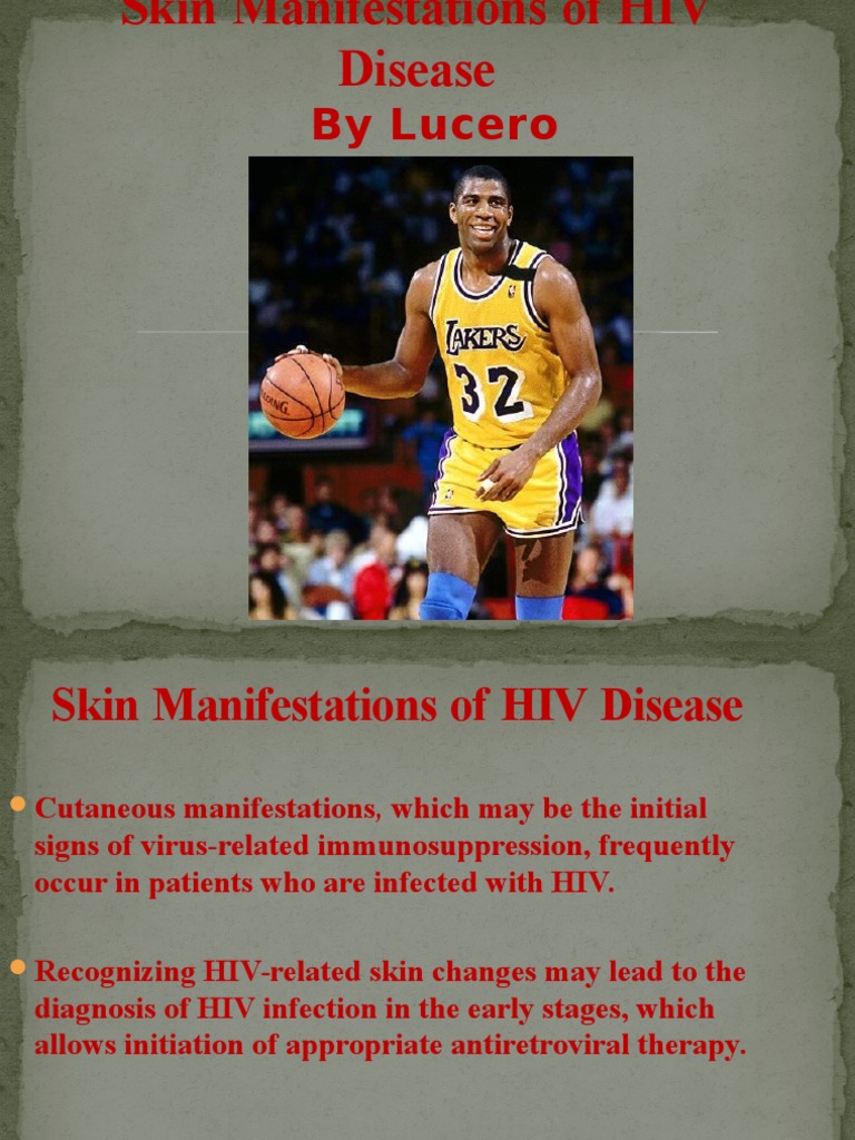 Skin Manifestations of HIV Disease | PDF | Hiv/Aids | Immunology