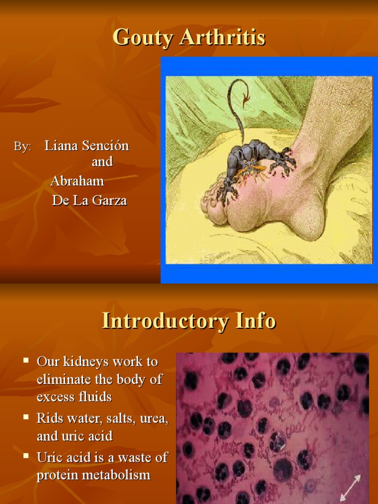 Understanding Gouty Arthritis | PDF