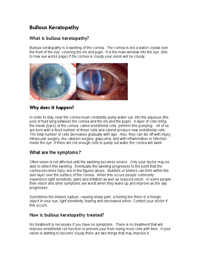 Bullous Keratopathy | PDF | Cornea | Human Eye