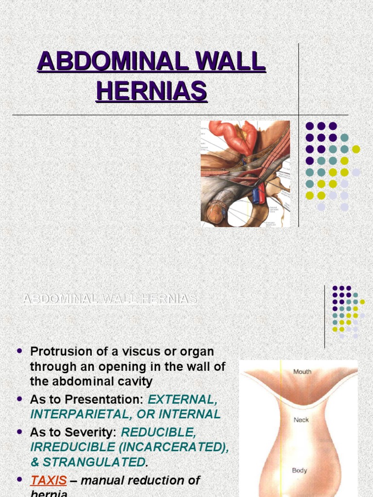 Abdominal Wall Hernias Overview | PDF | Abdomen | Anatomy