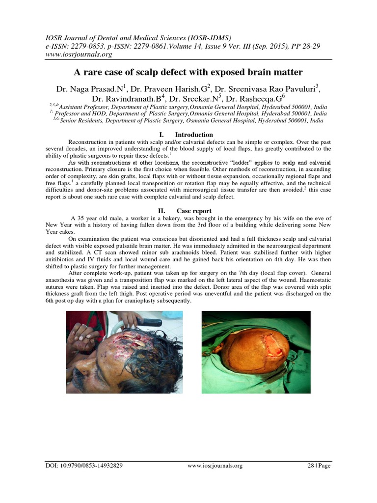 A Rare Case Of Scalp Defect With Exposed Brain Matter Pdf Plastic Surgery Surgery