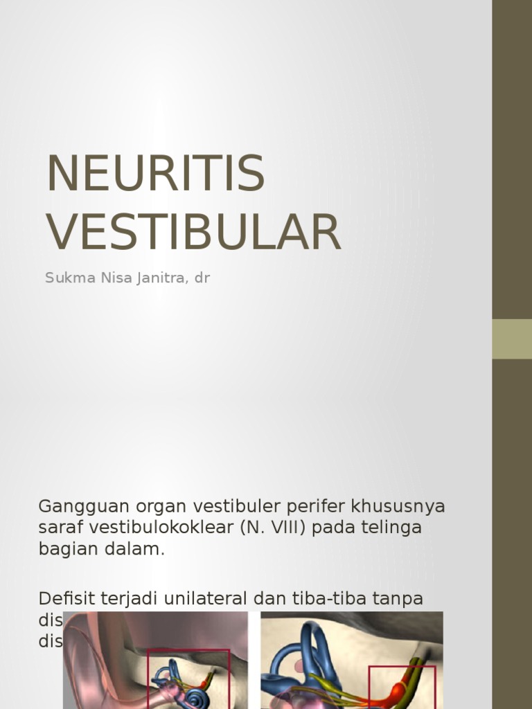 Neuritis Vestibular | PDF