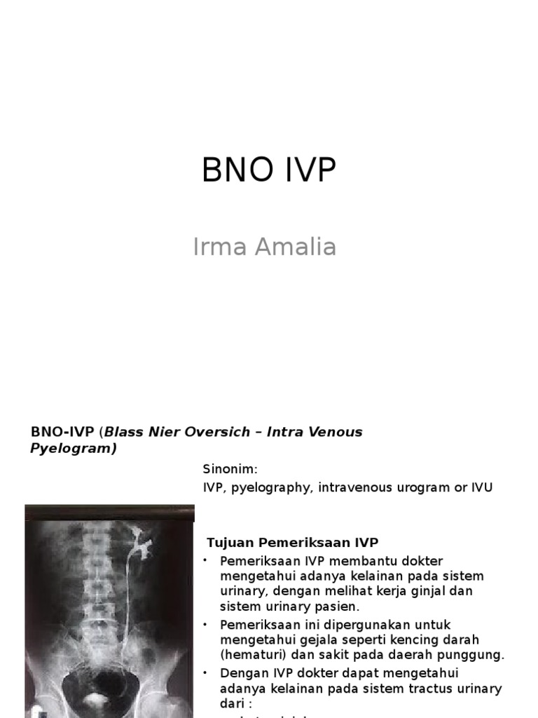 Bno Ivp | PDF