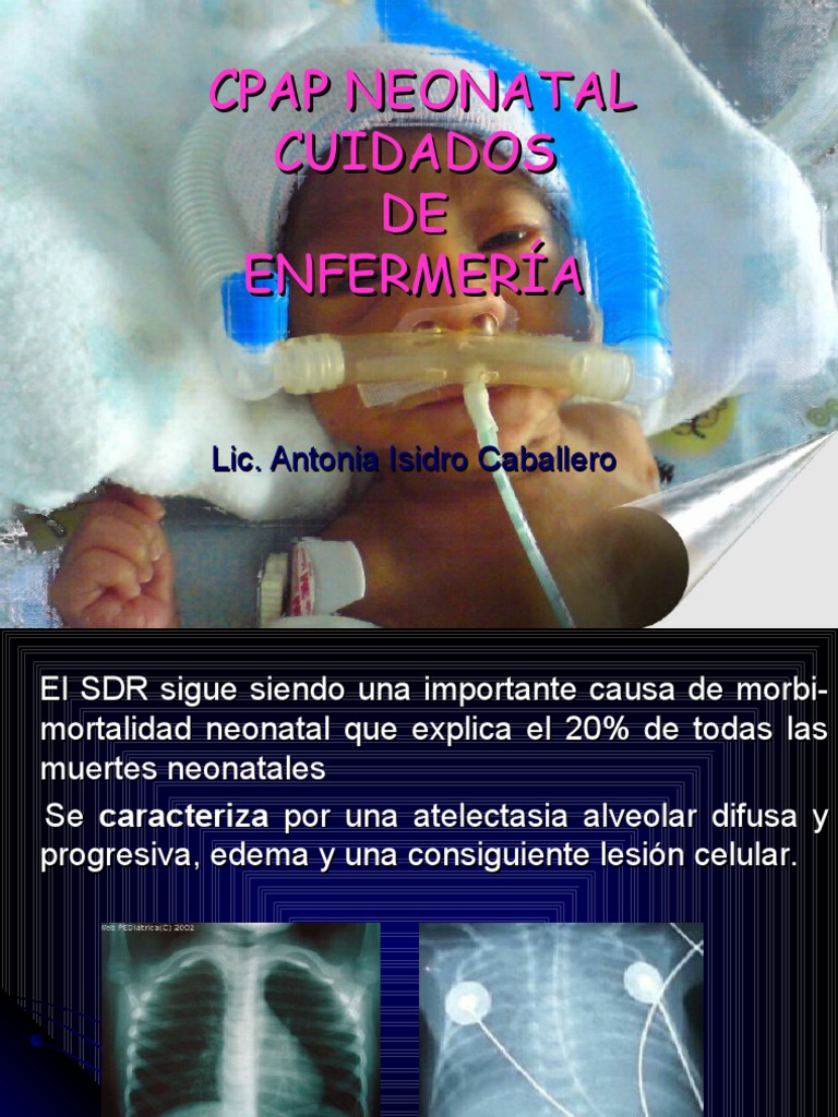 CPAP Neonatal. Cuidados de Enfermería.