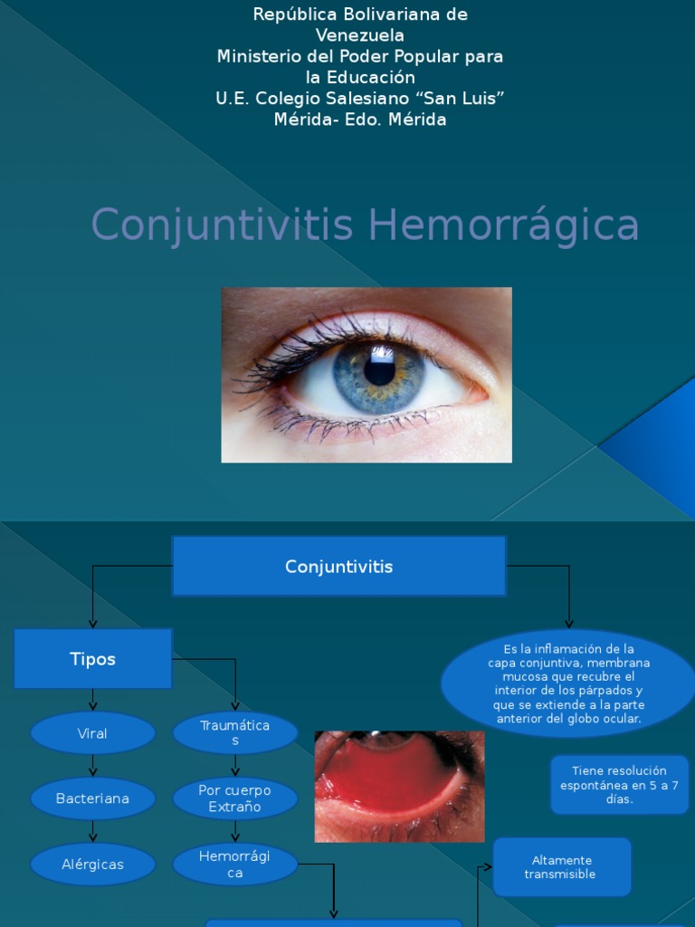 Conjuntivitis Hemorrágica | PDF