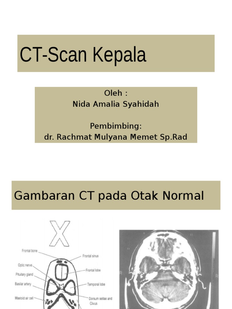 Expertise - Ct-Scan Kepala | PDF