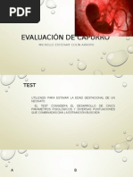 Test de Capurro | PDF | Infantes | Especialidades Medicas