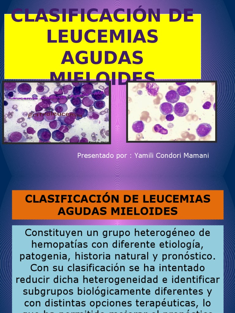 LMA clasificacion de leucemias mieloides agudas