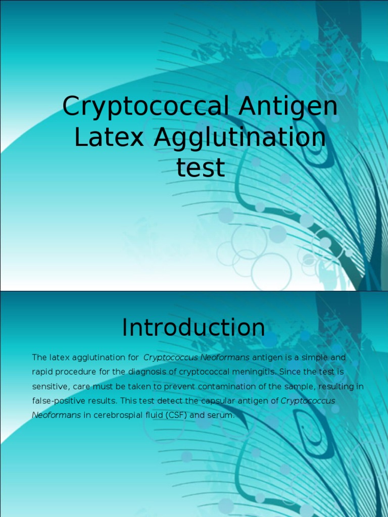Cryptococcal Antigen Latex Agglutination test JOSEPH.ppt | Public ...