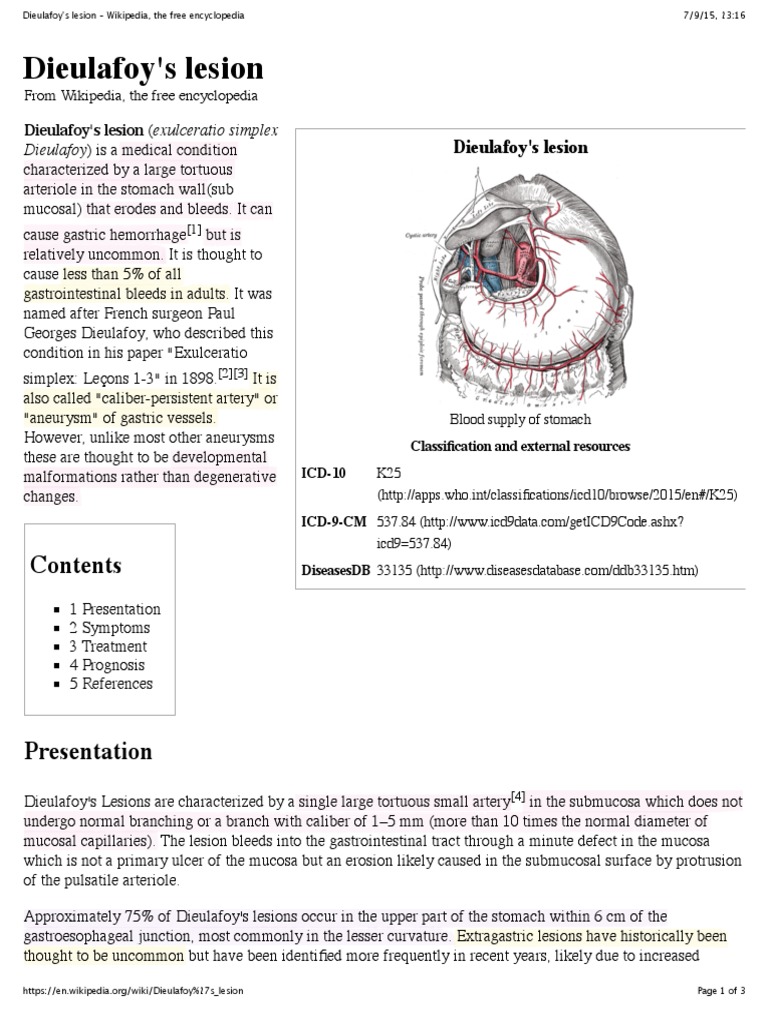 Wikipedia - Dieulafoy's Lesion (CHECKED) | PDF | Clinical Medicine ...