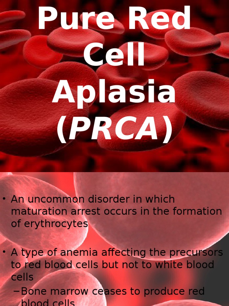 Pure Red Cell Aplasia PRCA | PDF | Red Blood Cell | Bone Marrow