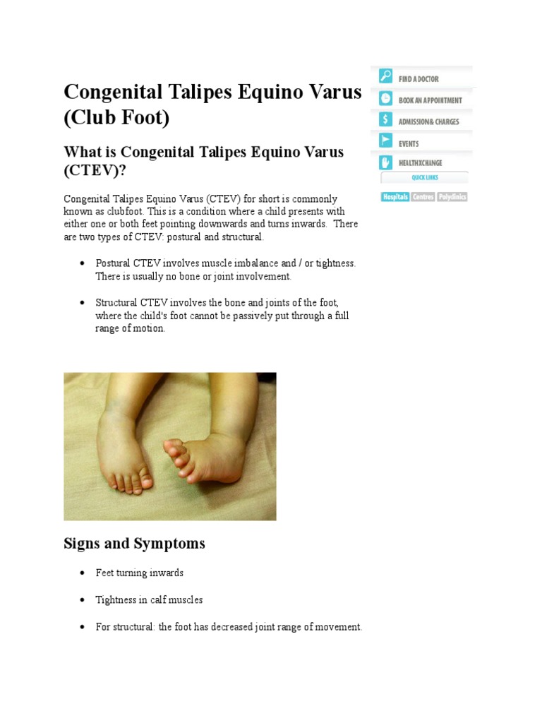 CTEV | PDF | Foot | Anatomical Terms Of Motion