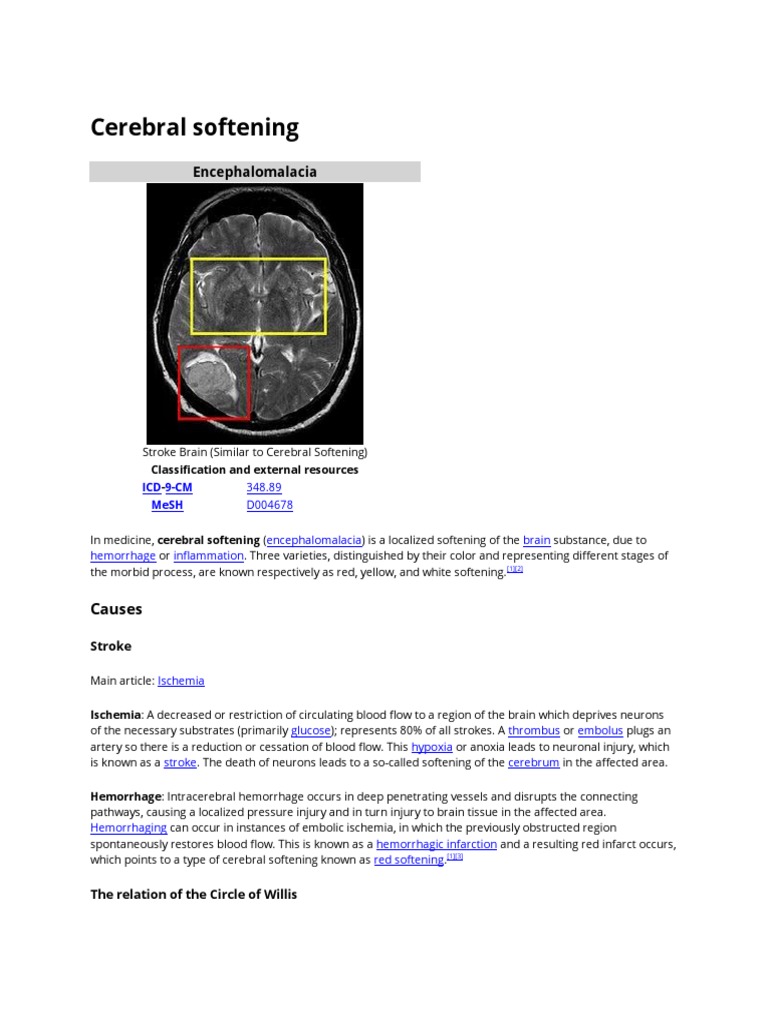 Encephalomalacia Cerebral Softening | Neuroanatomy | Epidemiology