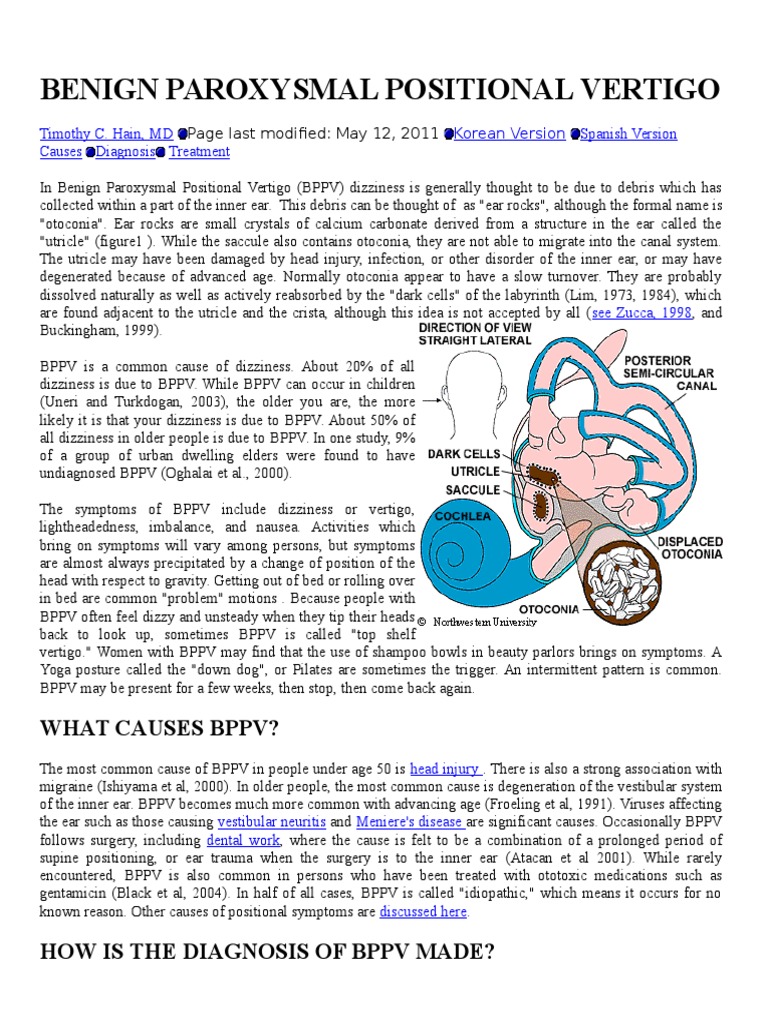 Benign Paroxysmal Positional Vertigo | Vertigo | Medicine