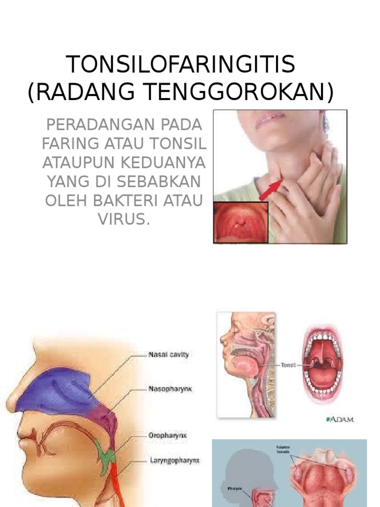 TONSILOFARINGITIS | PDF | Pengembangan Diri | Kesehatan Holistik