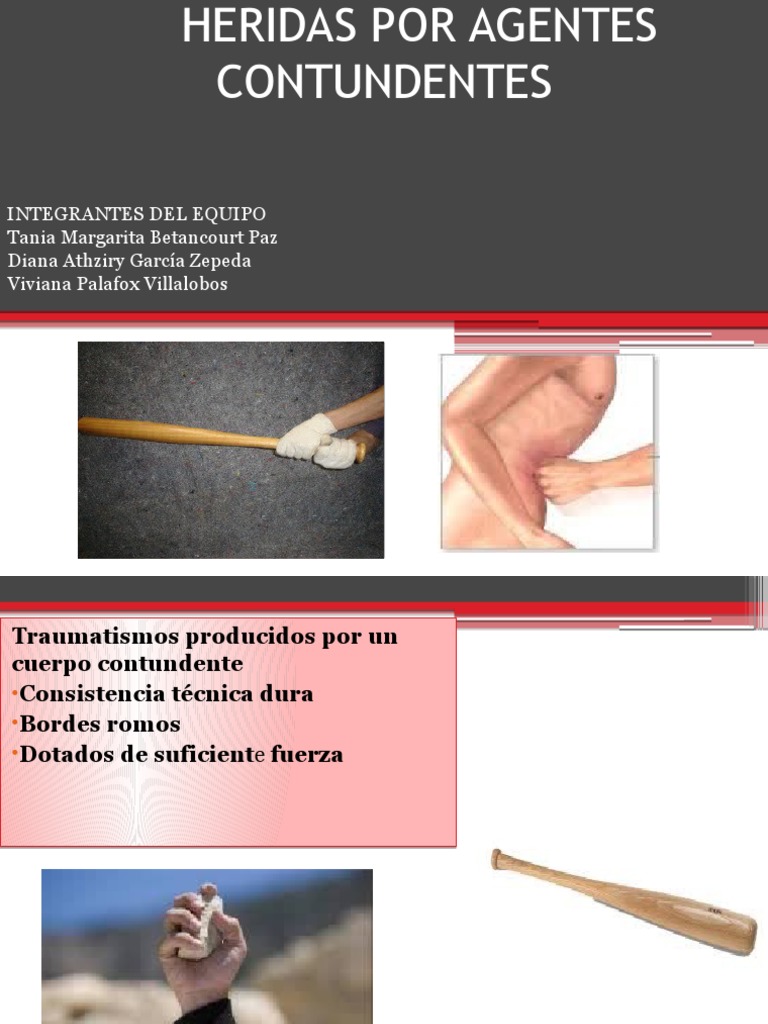 Heridas Por Agentes Contundentes - Copia | Lesión | Herida