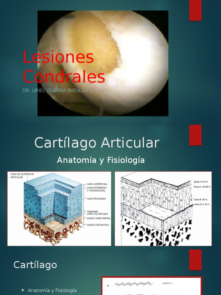 Lesiones Condrales | PDF | Cartílago | Sistema musculoesquelético
