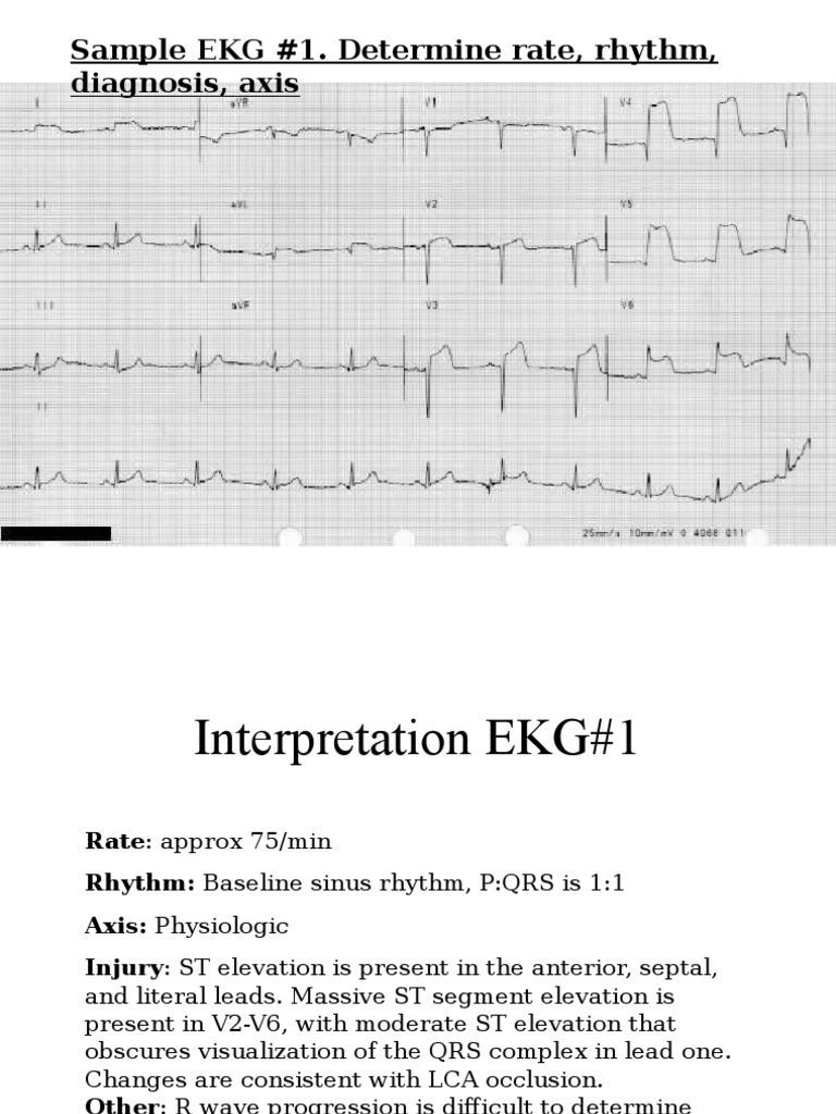 EKG Self Study Guide | PDF | Electrocardiography | Circulatory System