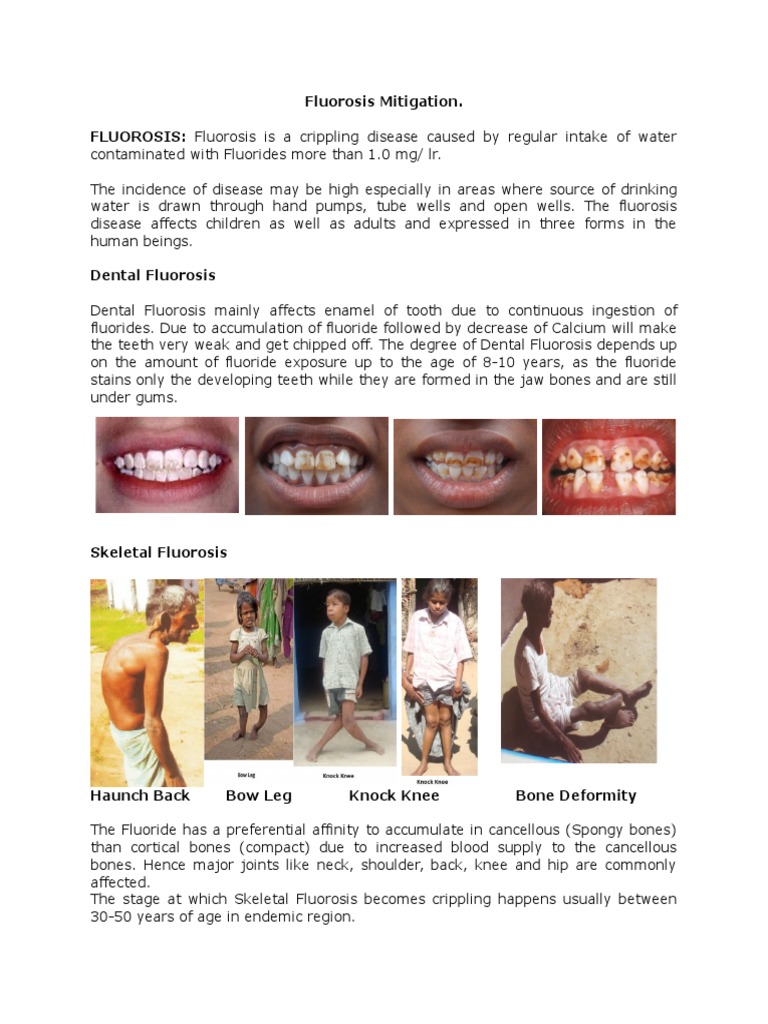 Fluorosis Types | PDF