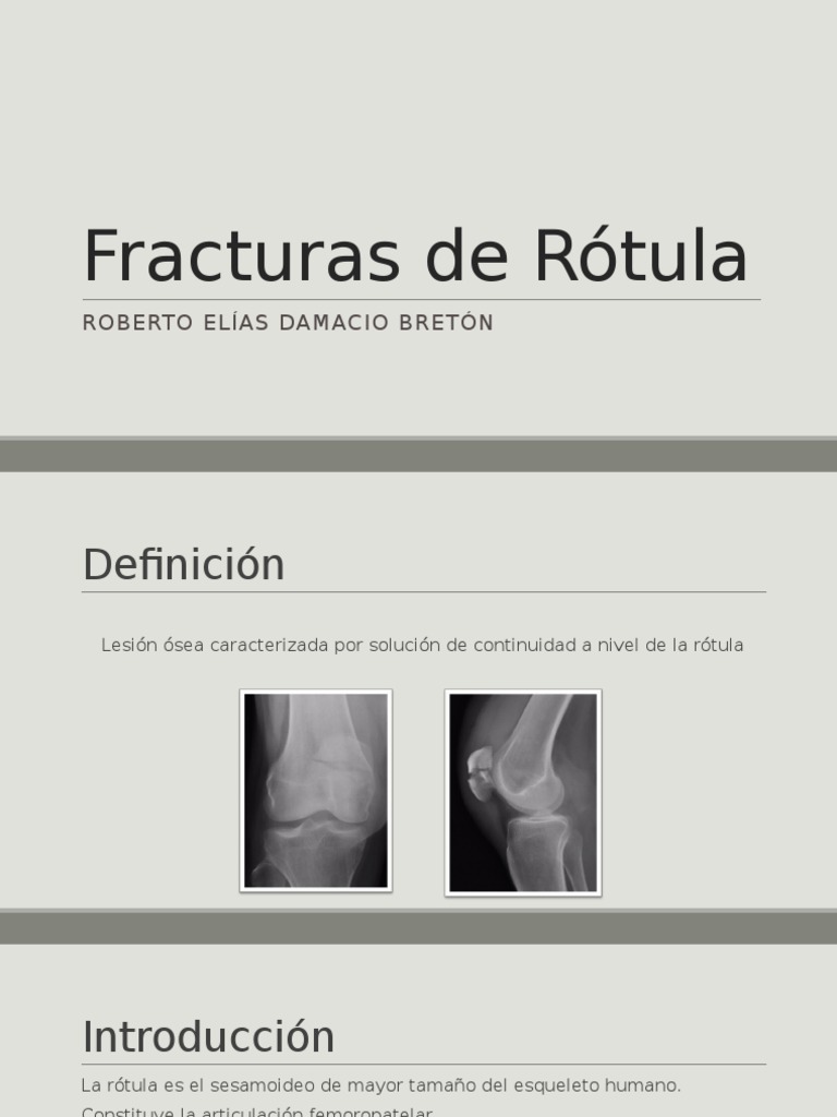 Clasificación y Tratamiento de Fracturas de Rótula | PDF | Rodilla ...