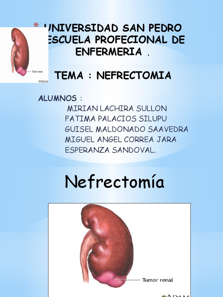 Nefrectomía-exposicion-terminada (2).pptx | Nefrología | Cirugía