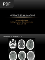 Reading Normal Head CT Scans | PDF | Ct Scan | Parietal Lobe