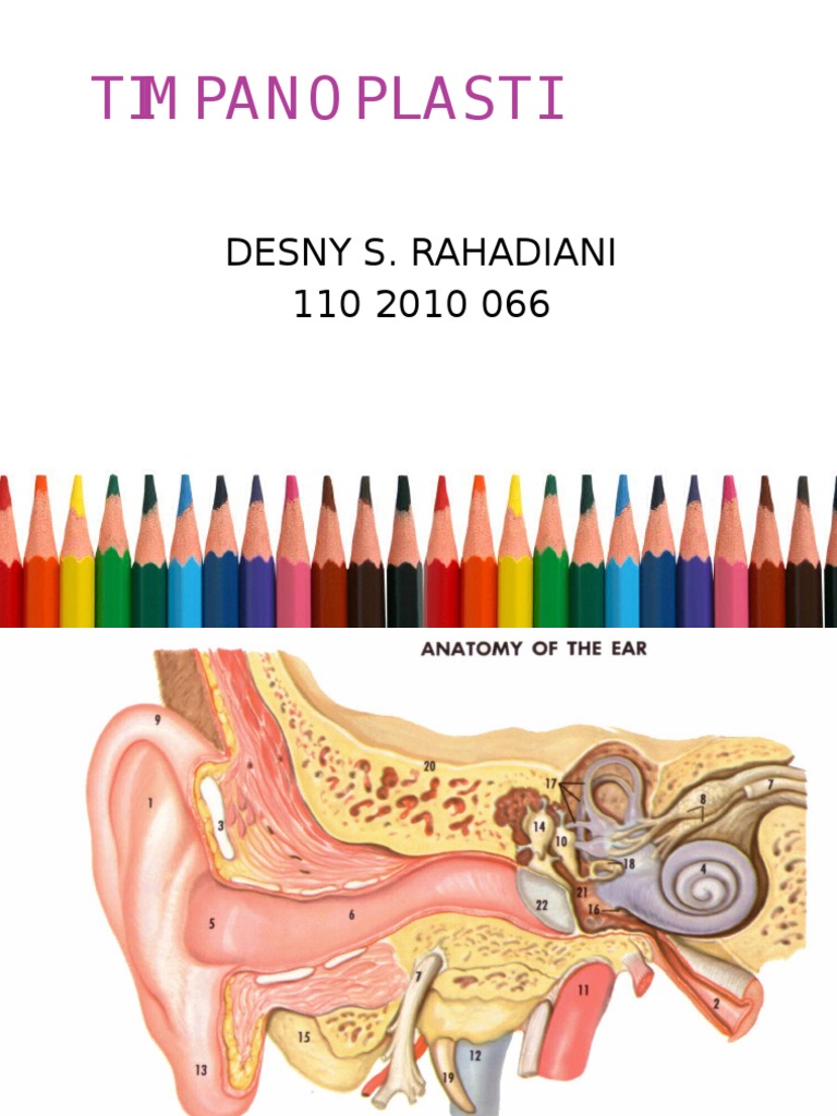 Timpanoplasti PPT Referat Desny | PDF