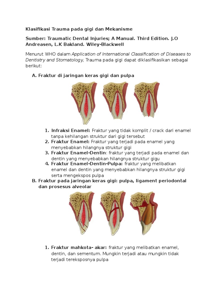 Klasifikasi Trauma Pada Gigi | PDF