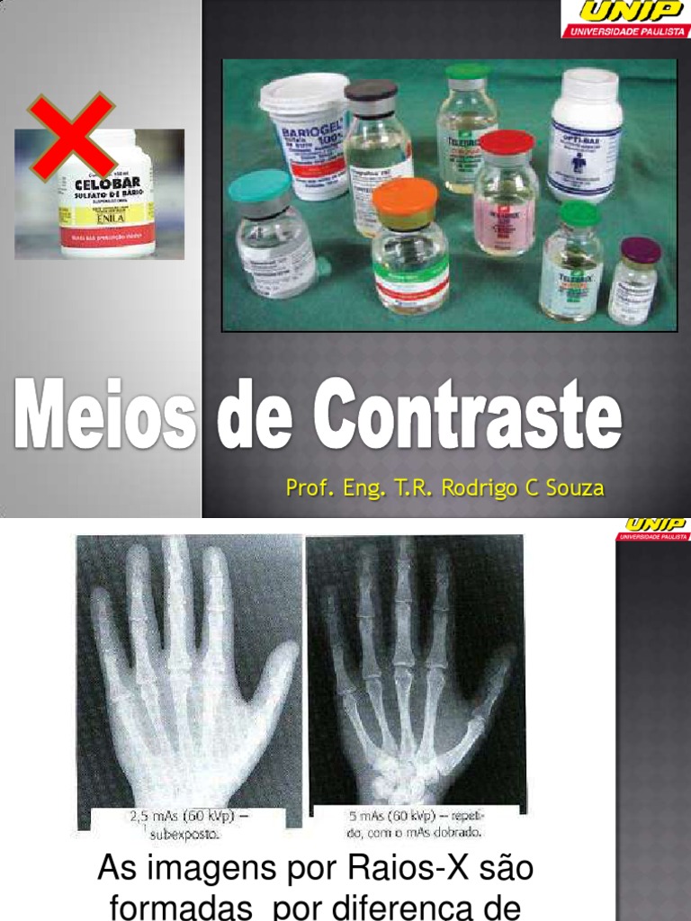 Contraste Radiológico - Iodo Bário Gadolíneo | PDF | Osmose | Medicina ...