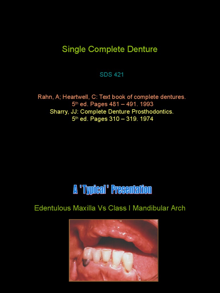Single Complete Denture | PDF | Dentures | Dentistry Branches
