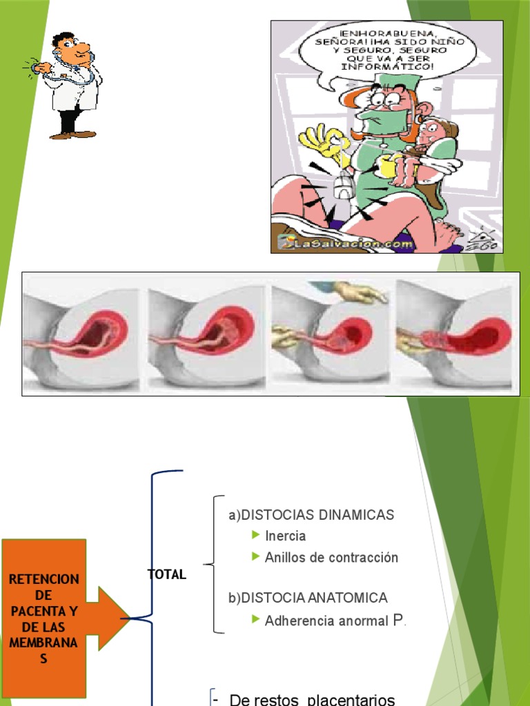 Retencion de Placenta | PDF | Placenta | Parto