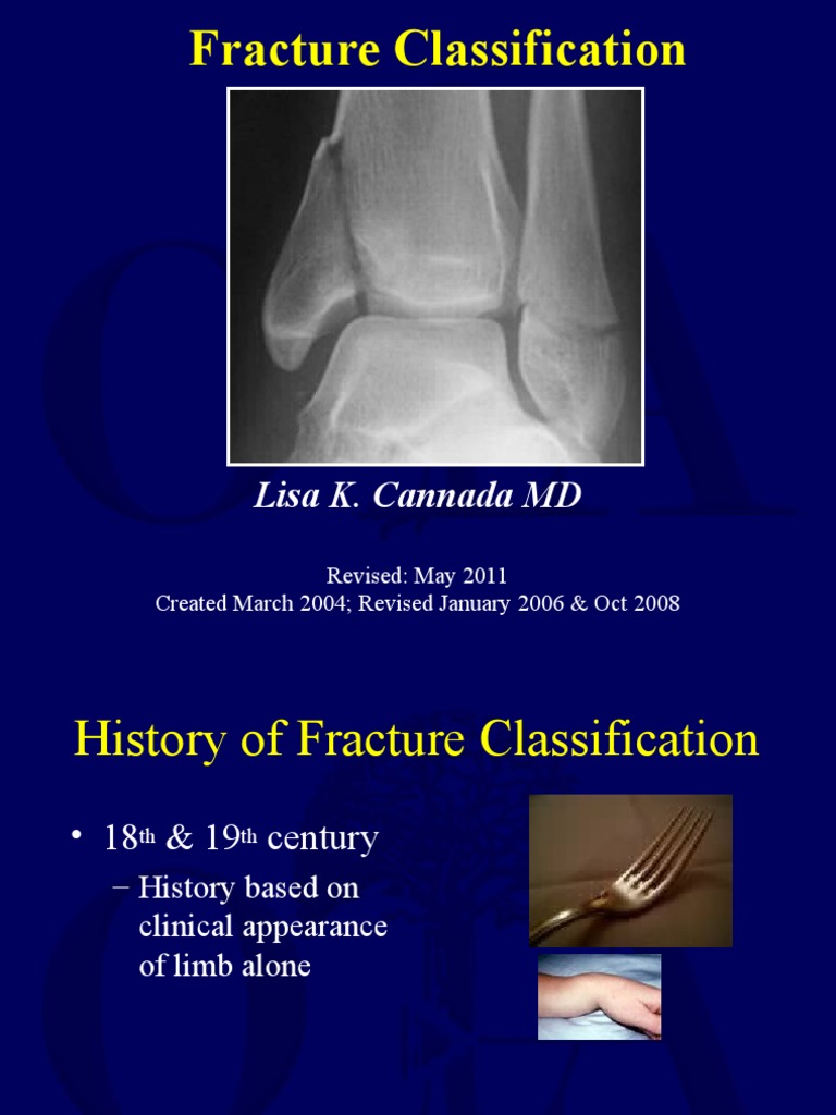 Fracture Classification | PDF | Musculoskeletal Disorders ...