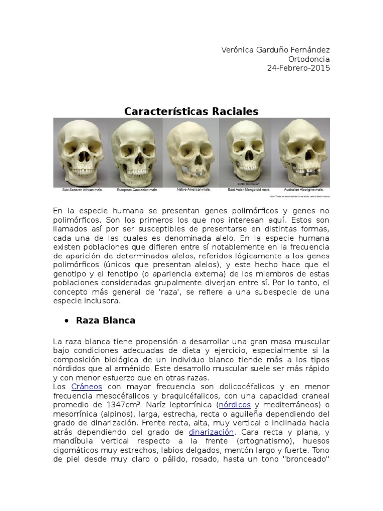 Caracteristicas Raciales