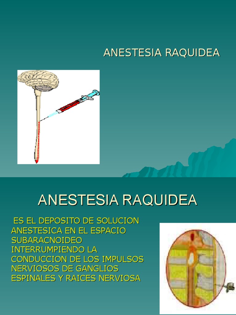 Anatomía y Técnica de Anestesia Raquídea | PDF | Anatomía humana ...